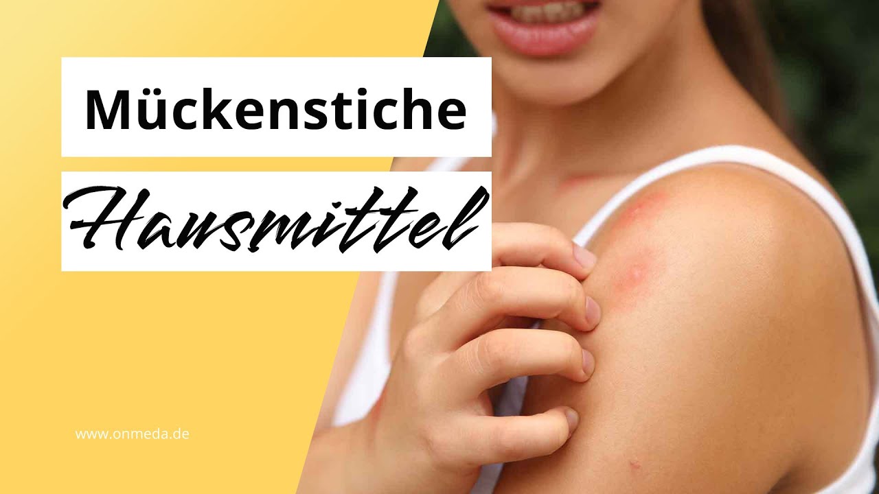 Juckreiz Muckenstich Hausmittel