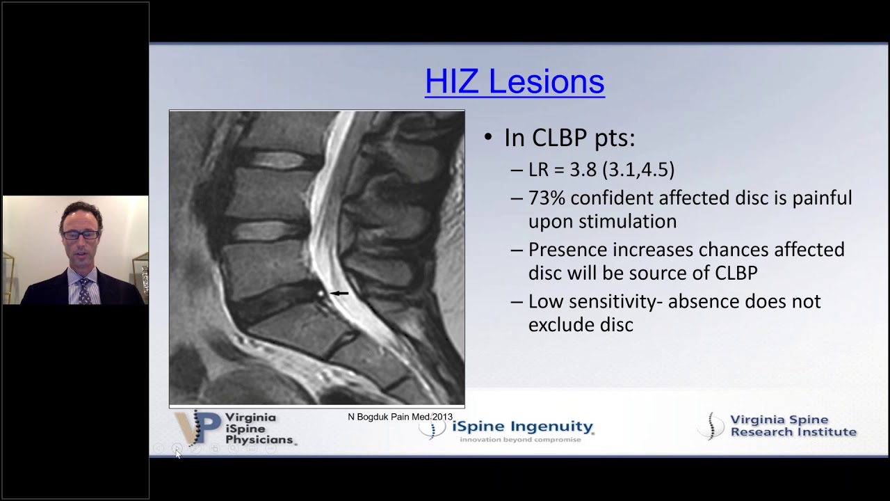 ASPN CME Webinar Series: Intradiscal Biologics - YouTube