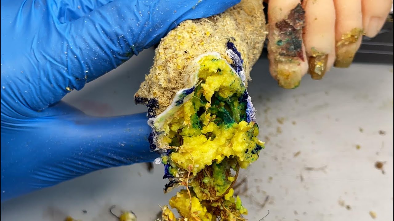 CUT Ingrown Toenails, Toenails with Maggots, Fungal Toenails ...