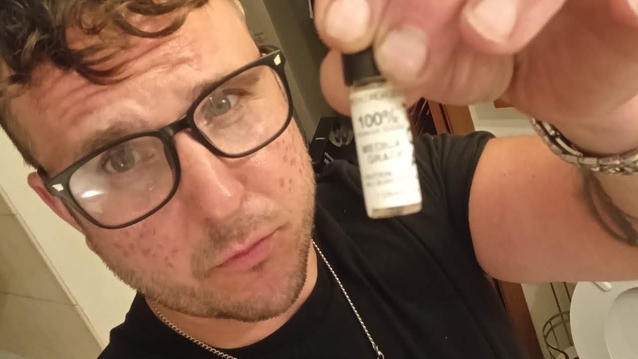DIY TCA cross and MICRONEEDLING (my journey so far) - YouTube