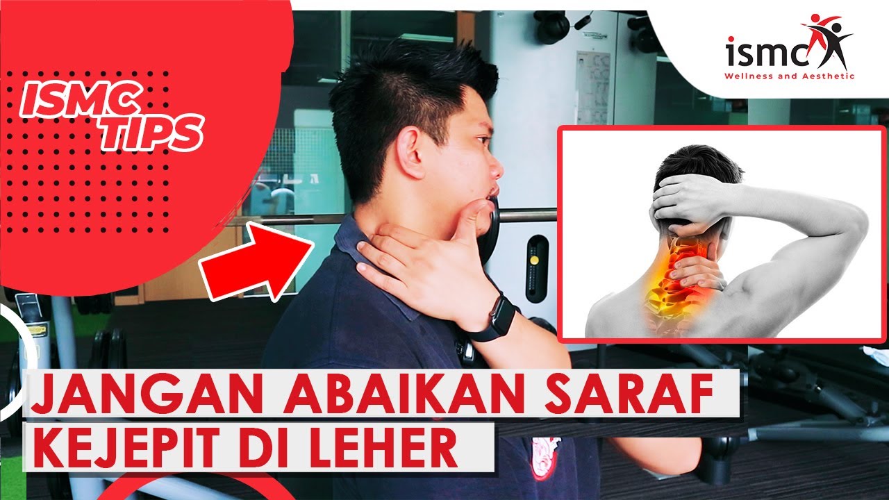 CARA MENGATASI SARAF KEJEPIT DI LEHER ‼️ | CERVICAL RADICULOPATHY - YouTube