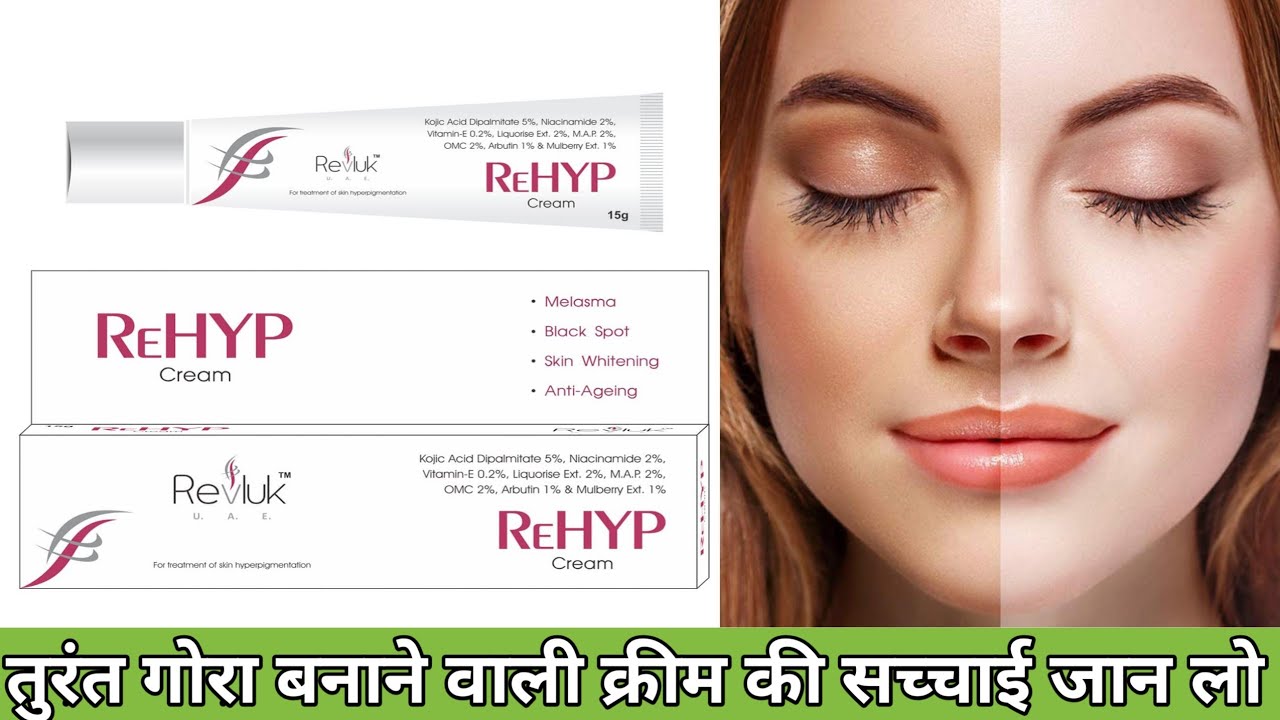 Gora Hone Ki Best Rehyp Cream | Rehyp Cream Uses in Hindi | Rehyp Cream ...