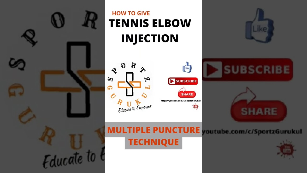 Tennis Elbow Injection: Multiple Puncture Technique! - YouTube