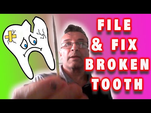 FILE 'N 'FIX BROKEN TOOTH QUICKLY EASILY! Quickly File a Sharp Broken ...