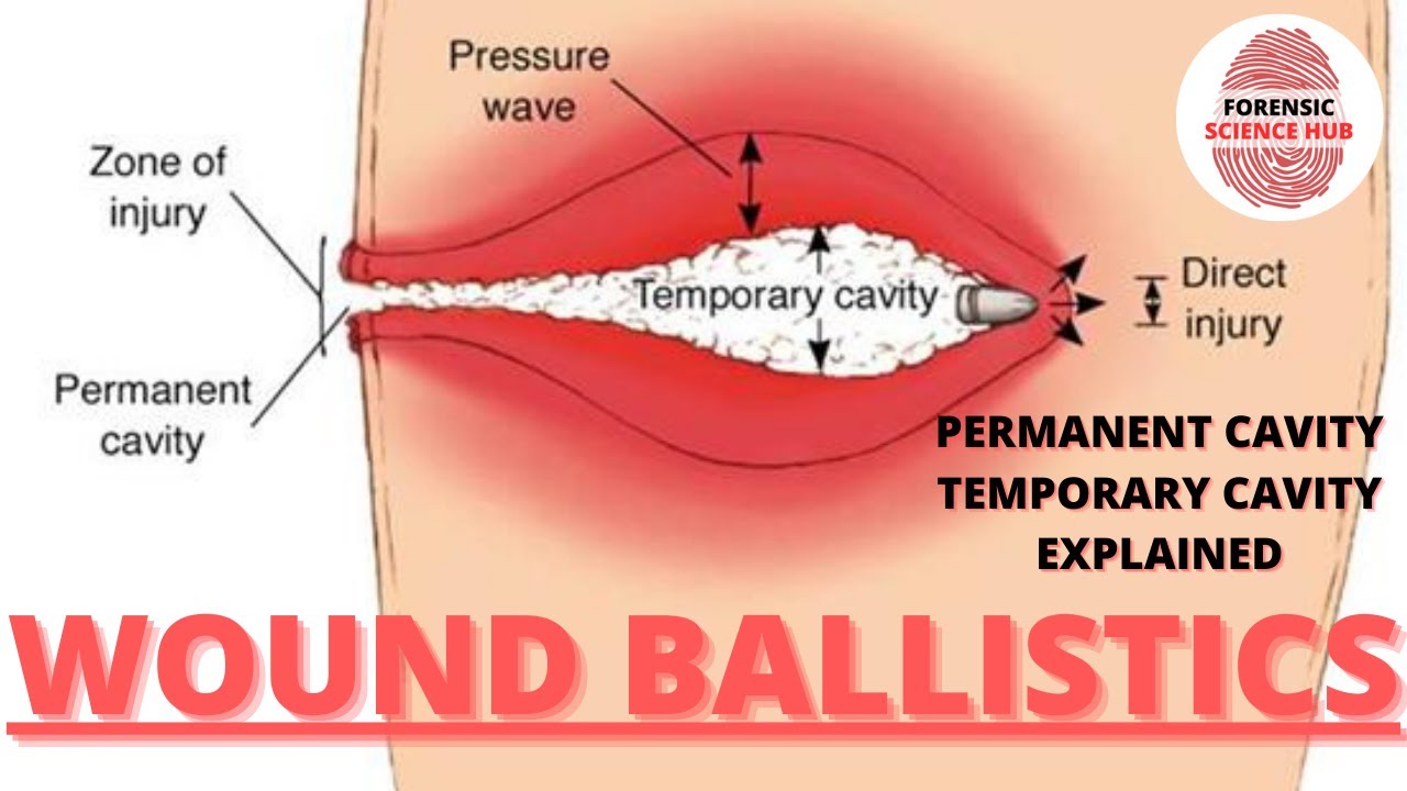 Ballastics Wound