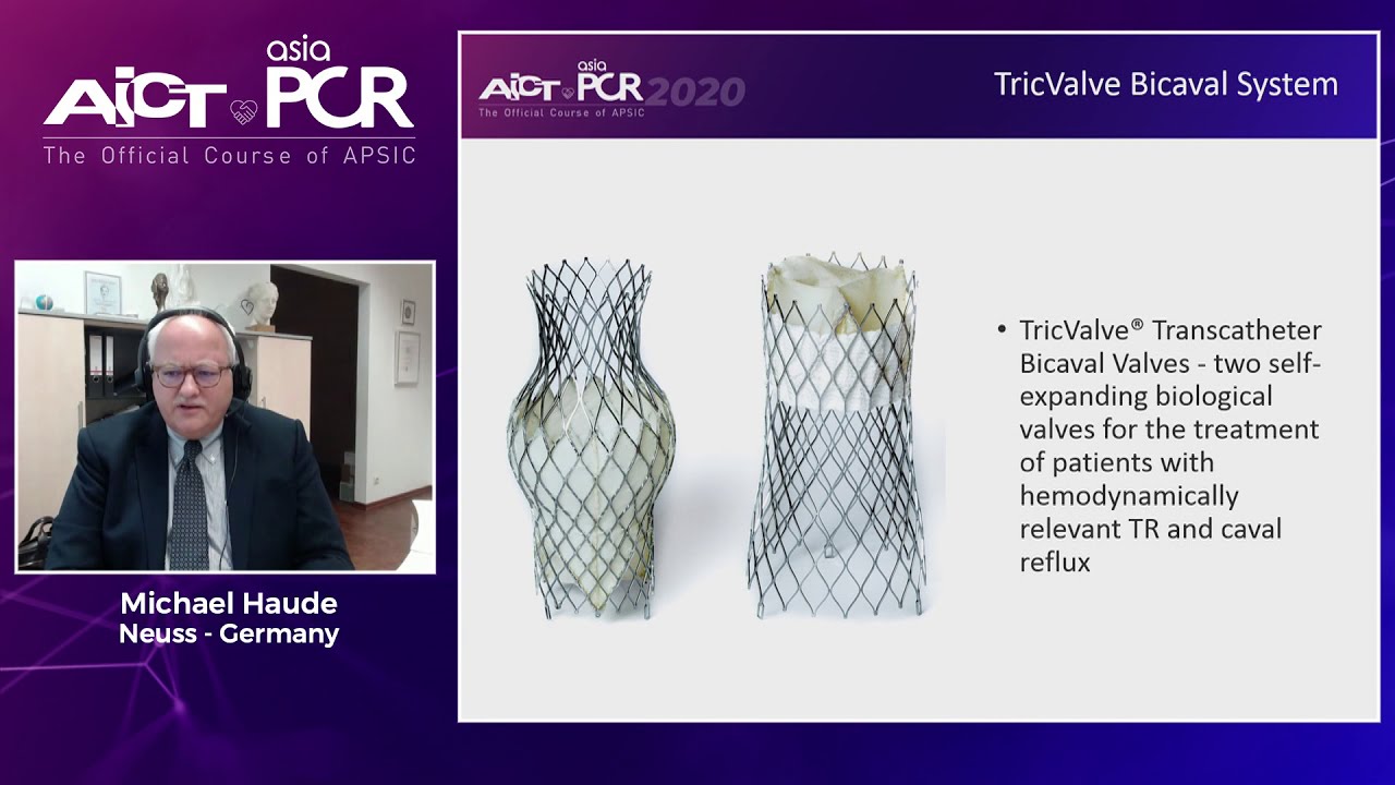 New horizons in tricuspid therapy – The tricvalve solution – AICT ...