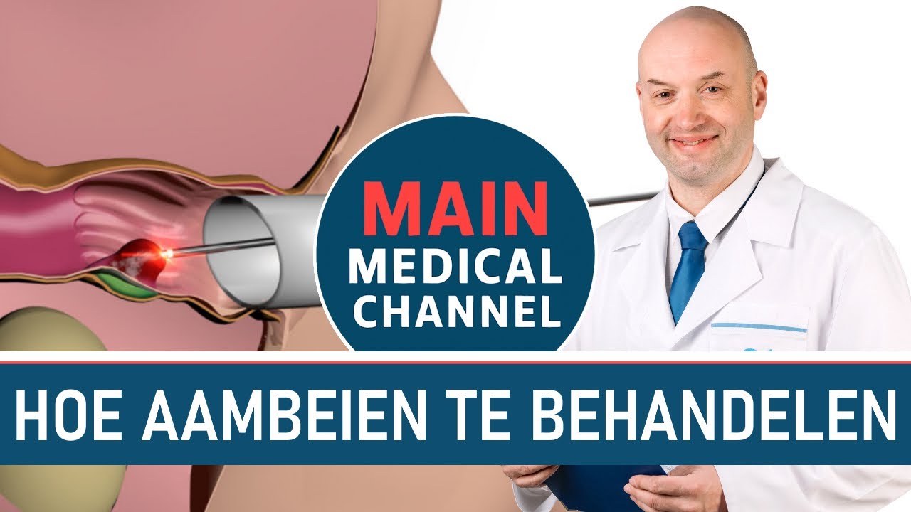 Hoe behandel je Aambeien bij vrouwen en mannen. Uitwendige en inwendige ...