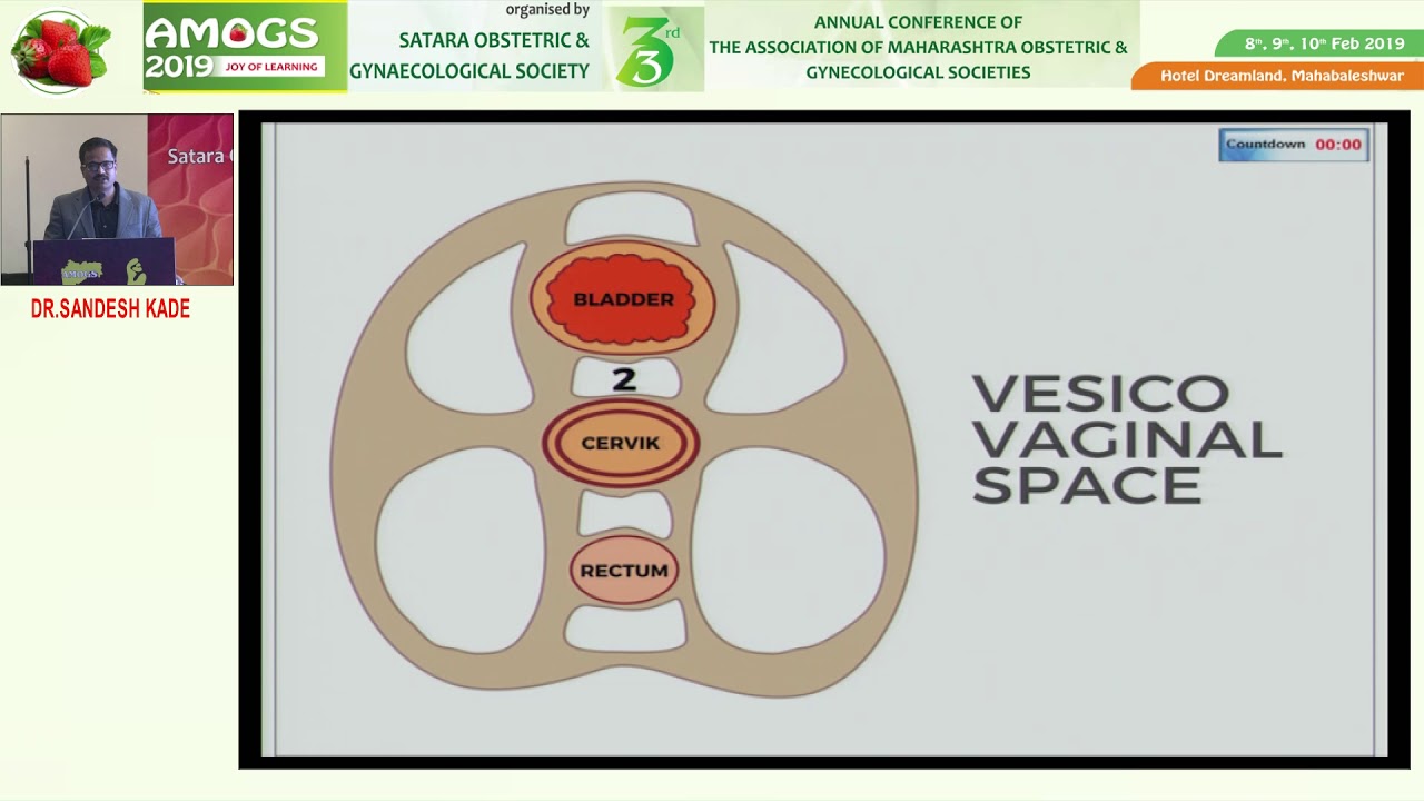 SOGS - AVASCULAR SPACES IN PELVIS DR SANDESH KADE . AMOGS 2019 - YouTube