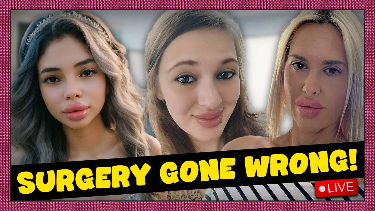 Makeovers GONE WRONG!! 😰 😟 BEFORE and AFTER Plastic Surgery DISASTERS!! 🫢 👀 - YouTube