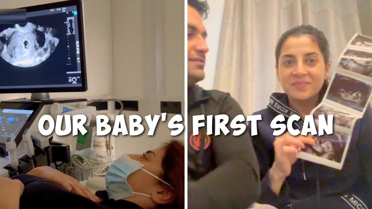 Our Baby's First Scan! Witness Our Emotional Reaction 🥹 Pregnancy Vlog ...