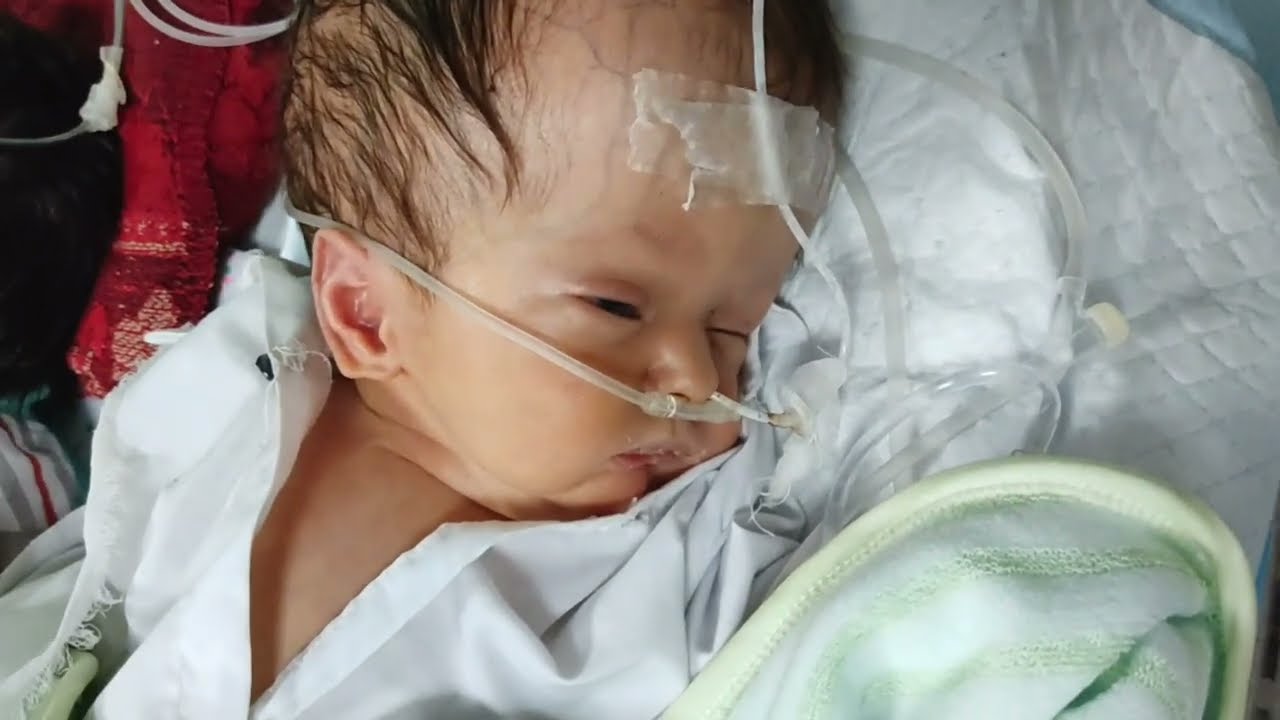 Newborn Twin babies with Head Full of water (Hydrocephalus) - YouTube