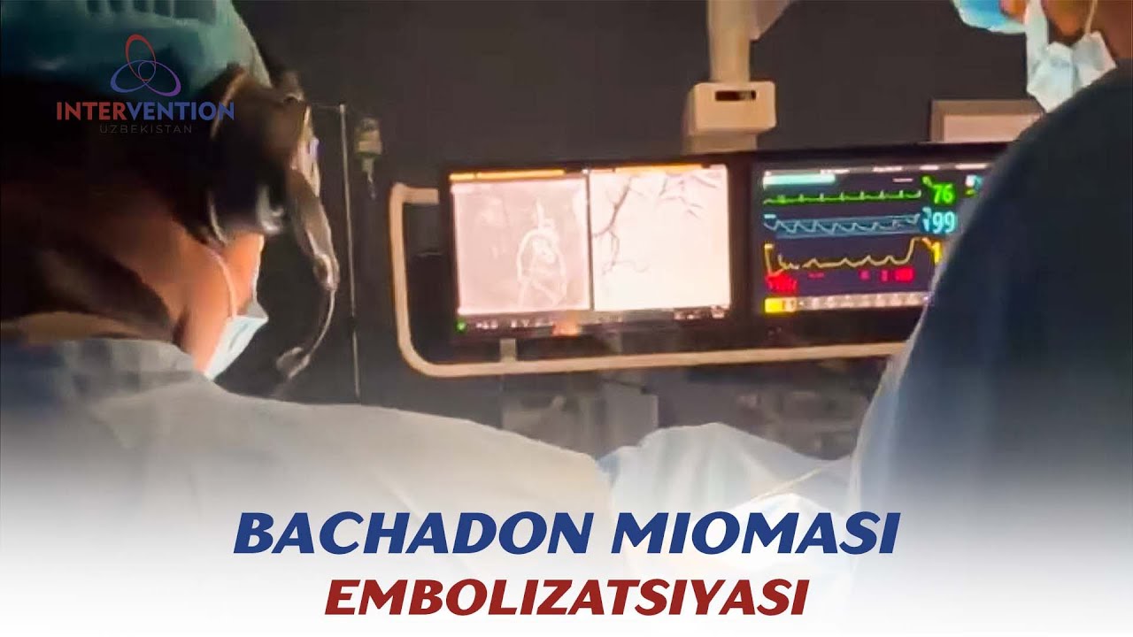 Bachadon MIOMAsi embolizatsiyasi - YouTube