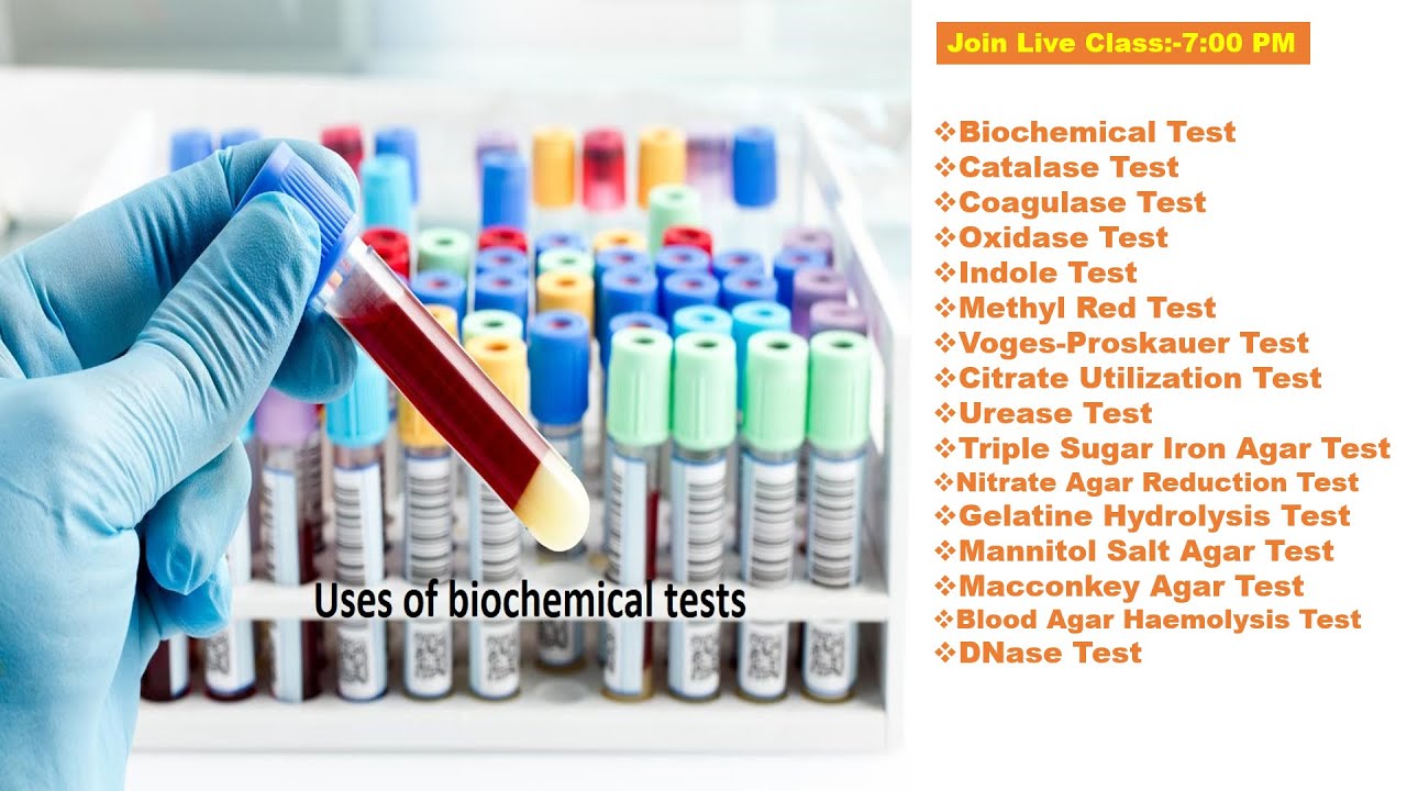 Biochemical Test:-Catalase Test, Coagulase Test, Oxidase Test, Indole ...