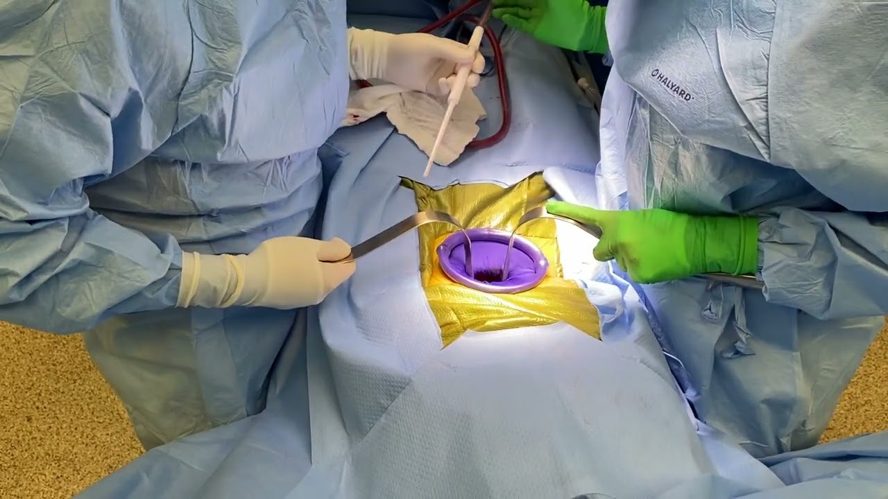 Example of exposure utilizing Alexis Ortho in ALIF procedure - YouTube