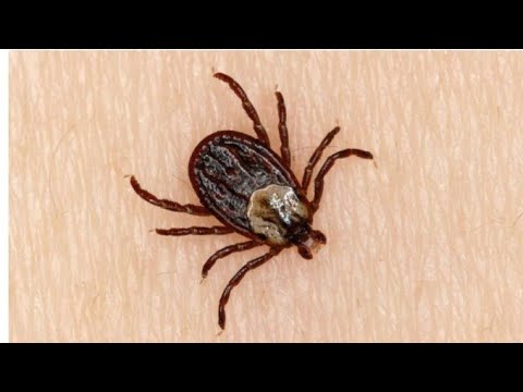 Metal detectorist’s #1 enemy- TICKS! How to stop them - YouTube