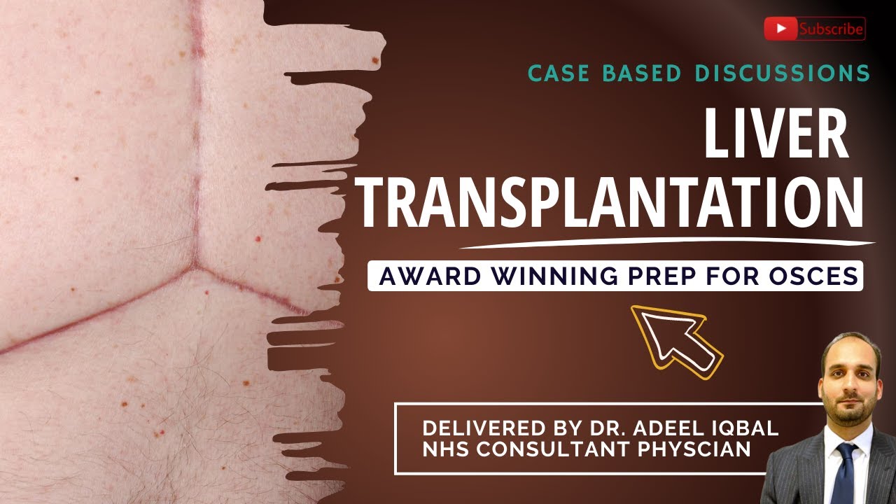 Liver Transplantation - Abdominal - BEST OSCE Preparation for Medical ...