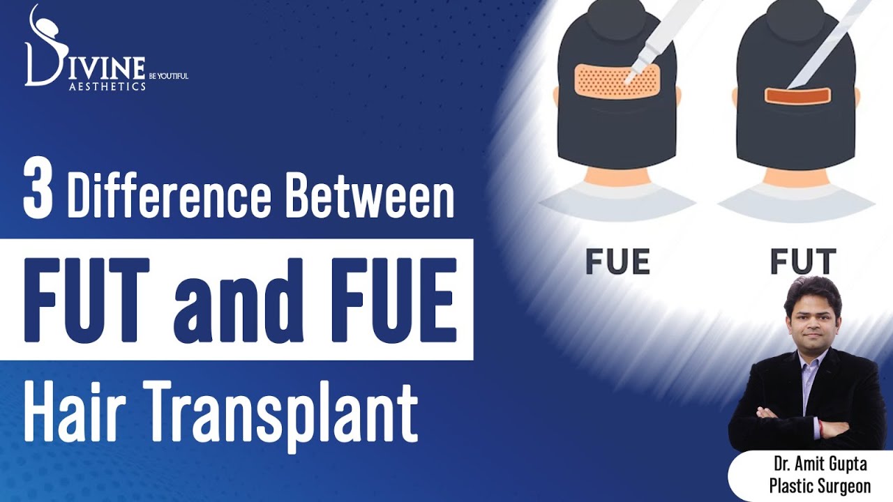 3 Differences Between FUE and FUT Hair Transplant | FUE Vs FUT | Dr ...