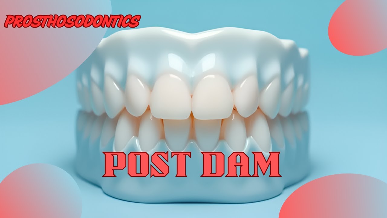 Prosthodontics Post Dam (Posterior Palatal Seal) (شرح بالعربي) - YouTube