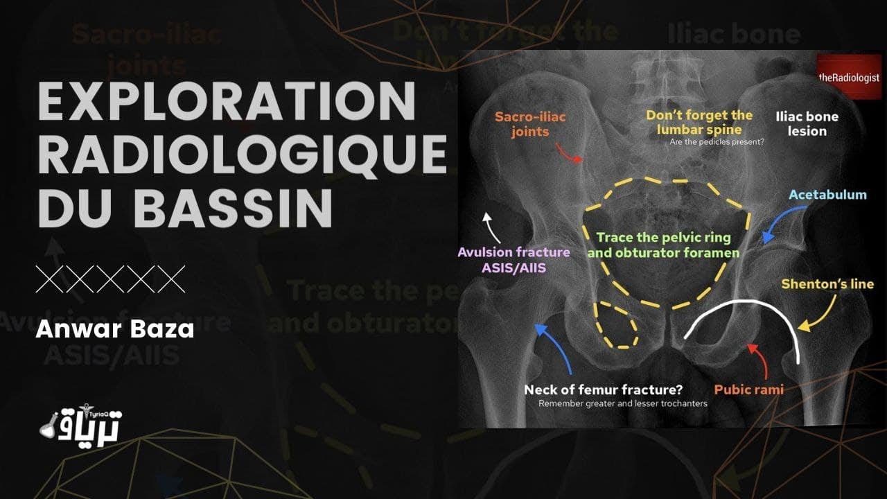 #Radiologie - EXPLORATION RADIOLOGIQUE DU BASSIN par ANWAR BAZA - YouTube