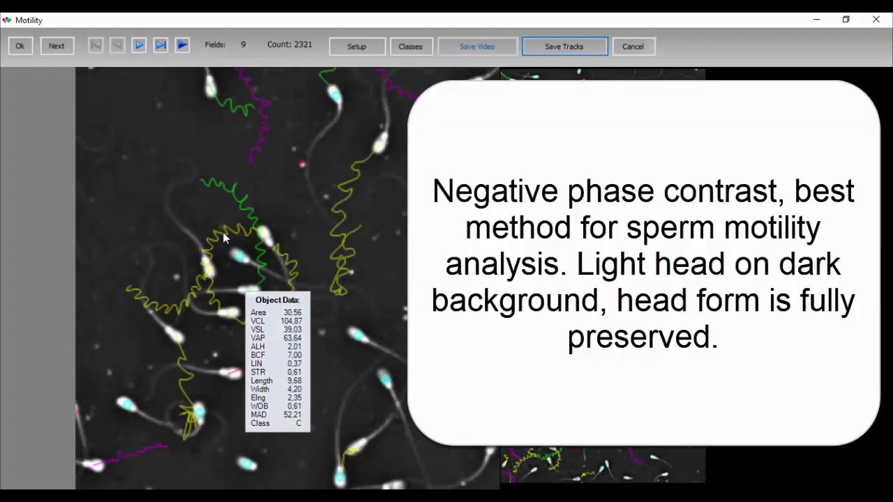 MMC Sperm: sperm analyzer, bull sperm motility, morphology, negative ...