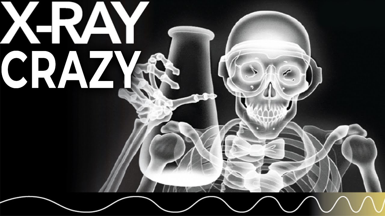 Top 10 Craziest X-Rays Ever - YouTube Top Media - YouTube