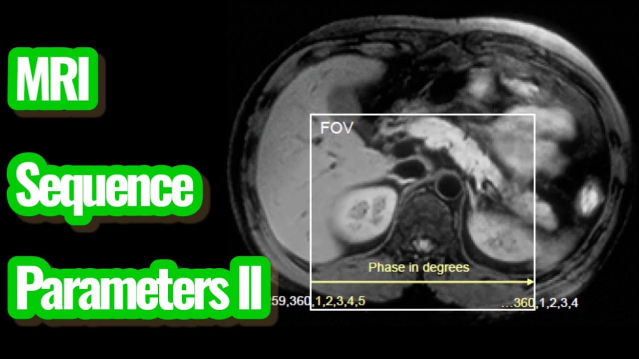 MRI Parameter Sequence 2 - YouTube