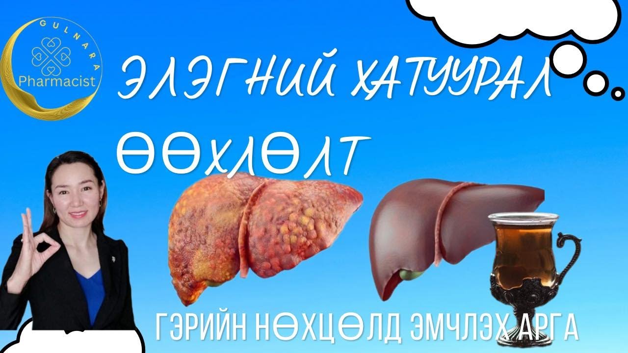 Элэгний өөхлөлт Элэг өөхлөх шалтгаан Урьдчилан сэргийлэх гэрийн арга