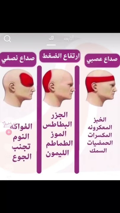 أنواع صداع الرأس وطرق علاجه Youtube