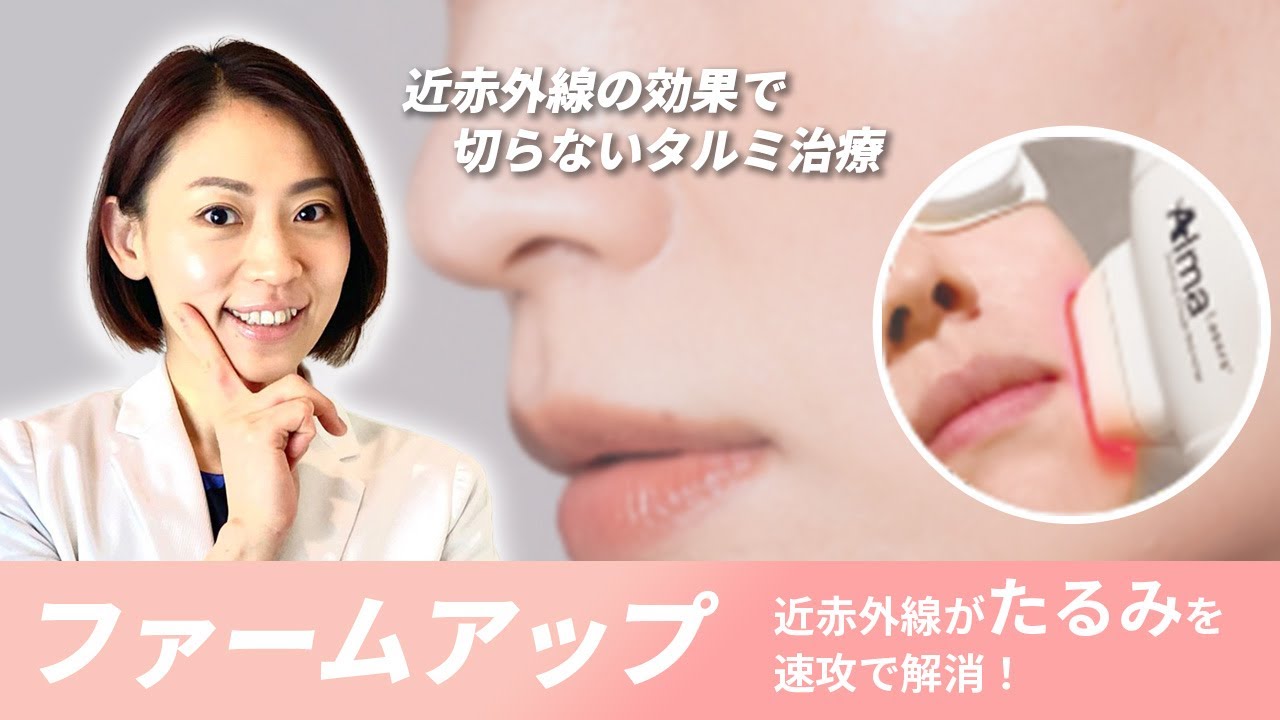 近赤外線がたるみを一気に引き上げる治療！【ファームアップ】 Youtubeeoi 6392