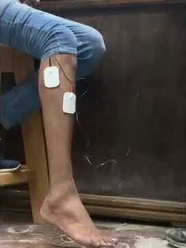 Neuromuscular Electrical Stimulation (NMES) for Common Peroneal Nerve - YouTube