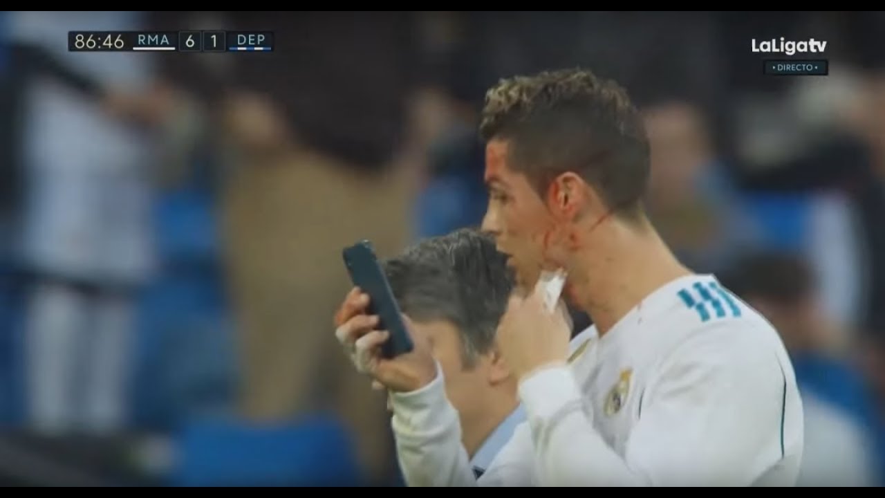 Cristiano Ronaldo Face Injury 2018 While Giving Head Goal on Real ...