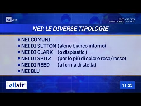 Nei della pelle: parliamone a 360°! - YouTube