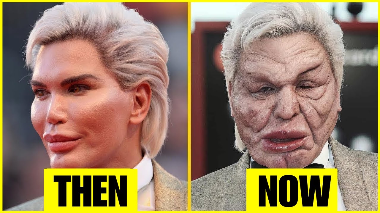He Was a Famous Actor Before His Plastic Surgery , Guess Who? | Then ...