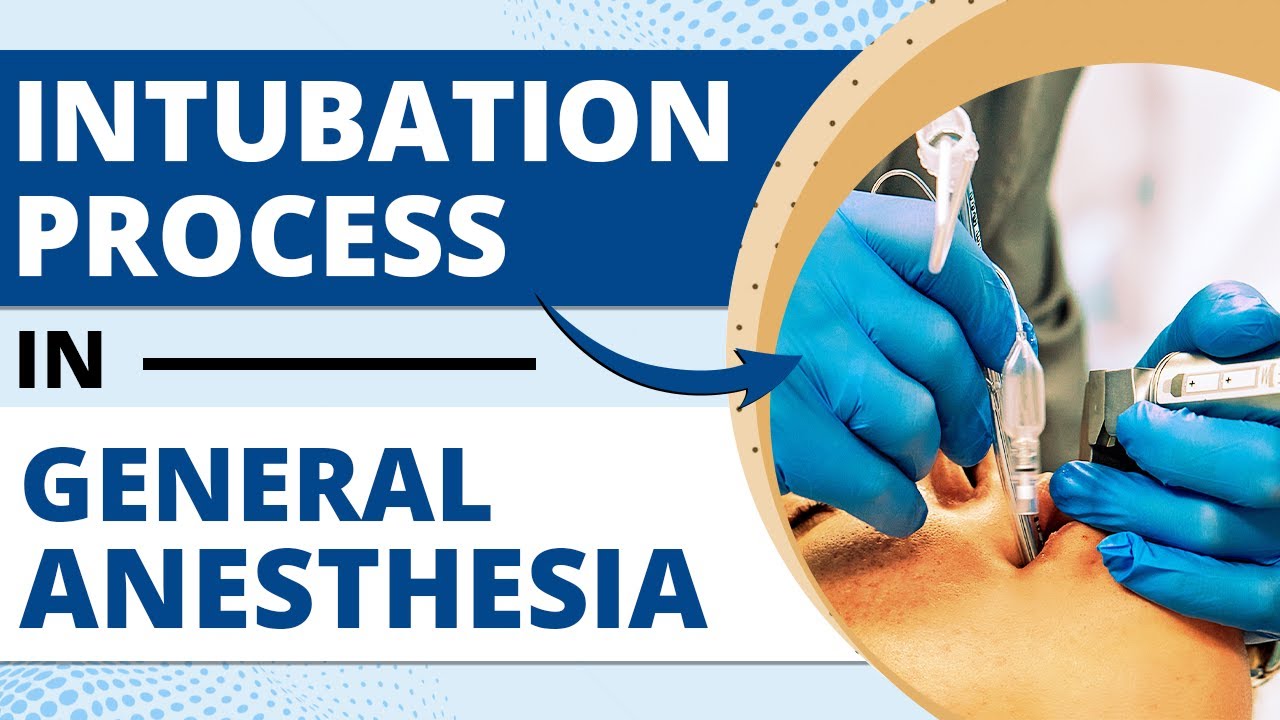 Intubation Process in General Anesthesia #intubation #criticalcare # ...