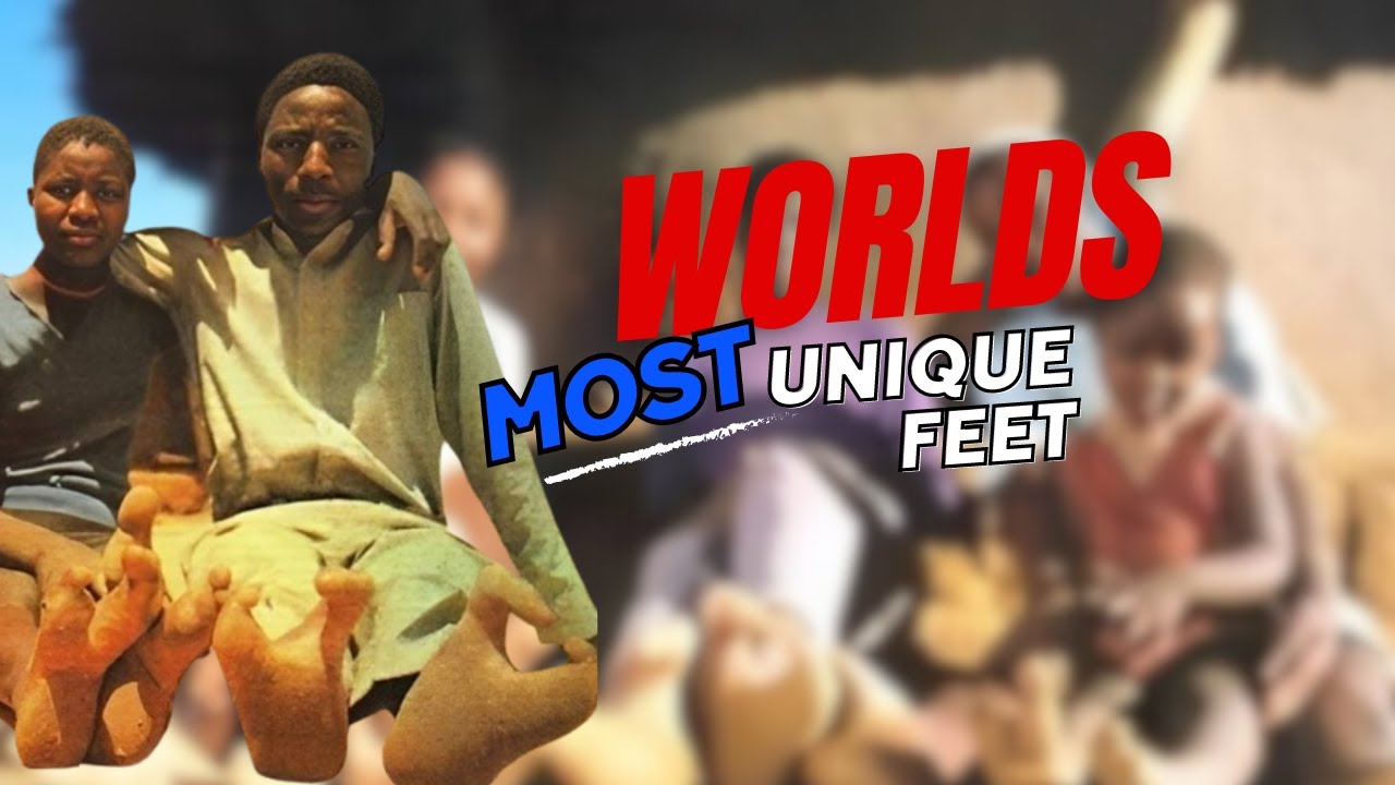 Unbelievable: African Nomadic Tribe with 2 Toes - YouTube