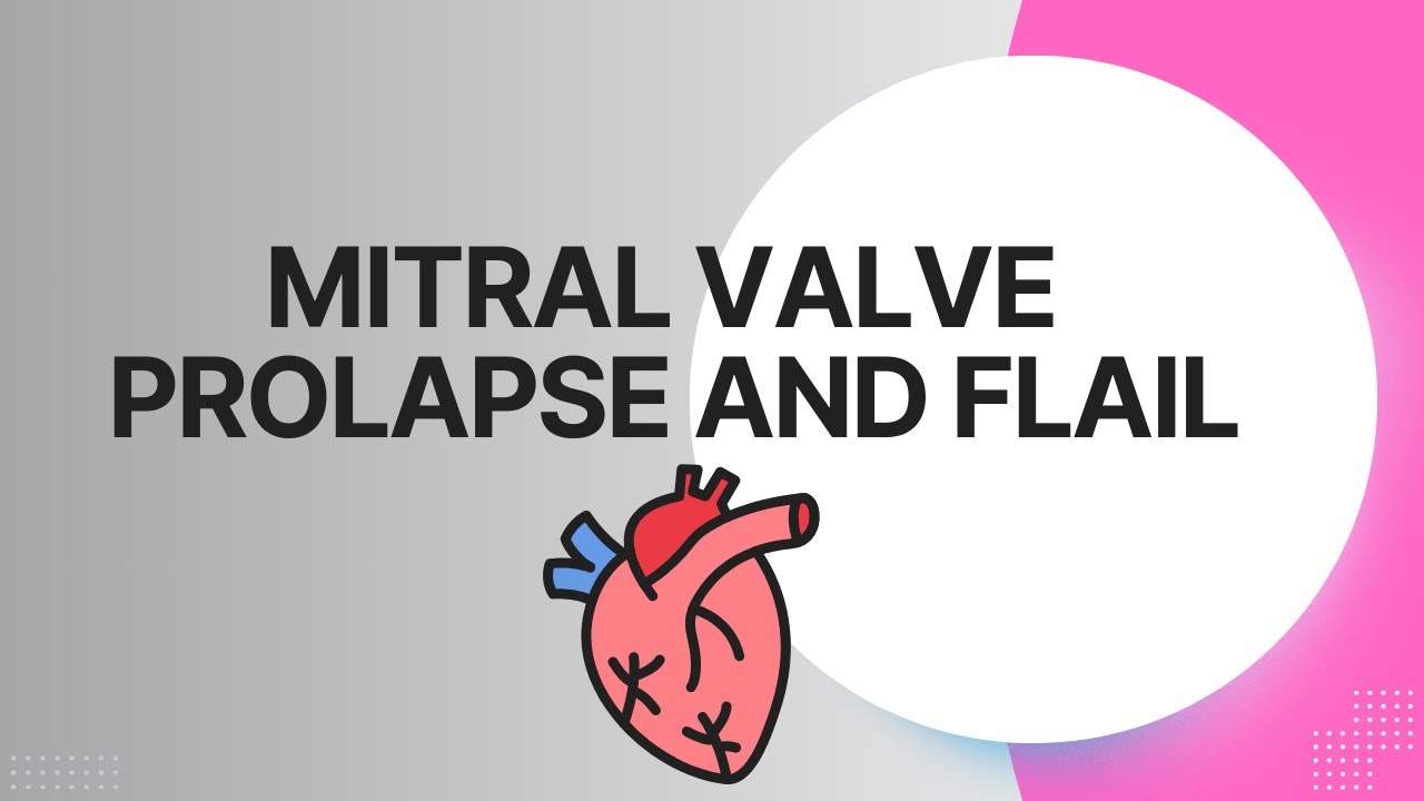 Mitral valve prolapse and flail - ( Etiology, pathology ,symptoms ...