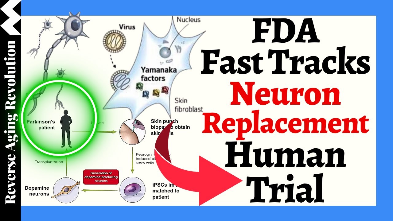 FDA Fast Tracks CELLULAR Reprogramming NEURON Replacement HUMAN ...