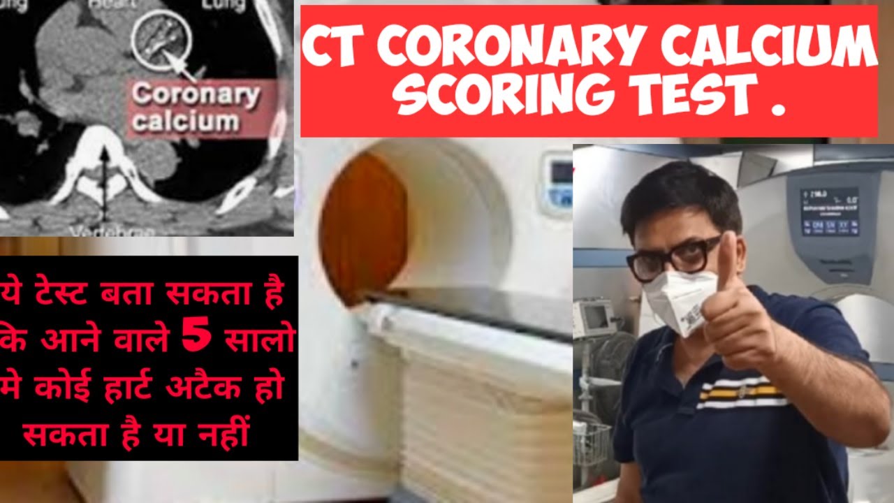 CT coronary calcium scoring Test ! ये टेस्ट बता सकता है कि आने वाले 5 ...