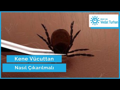 Kene Vücuttan Nasıl Çıkarılmalı | Kene Çıkarma | Prof. Dr. Vedat TURHAN