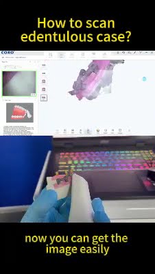 COXO D 300P Intraoral Scanner How to scan edentulous case Part II - YouTube