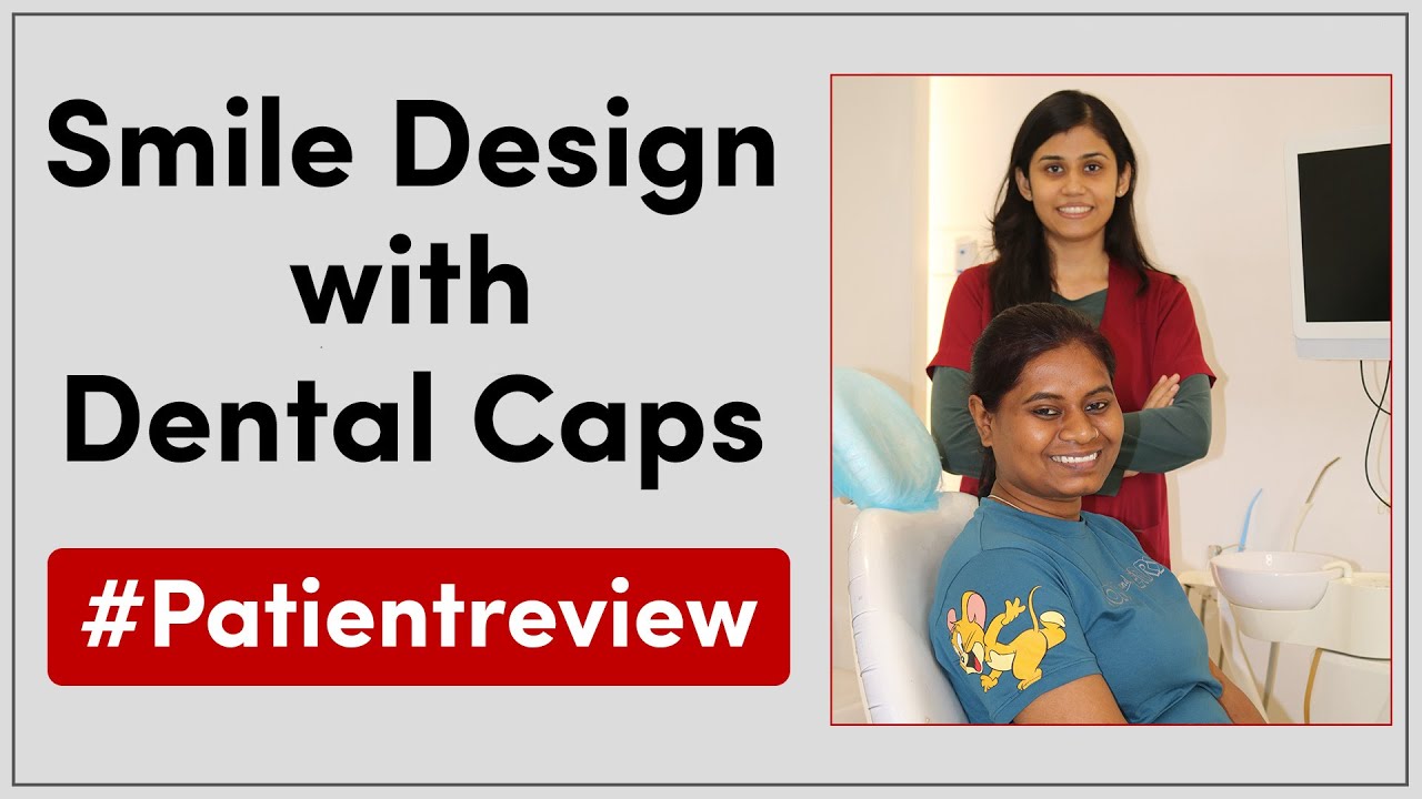 Smile Design with Dental Caps | Patient Review | Seraphic Dental ...
