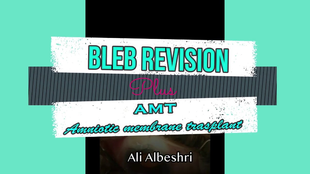 Bleb revision with amniotic membrane transplant - YouTube