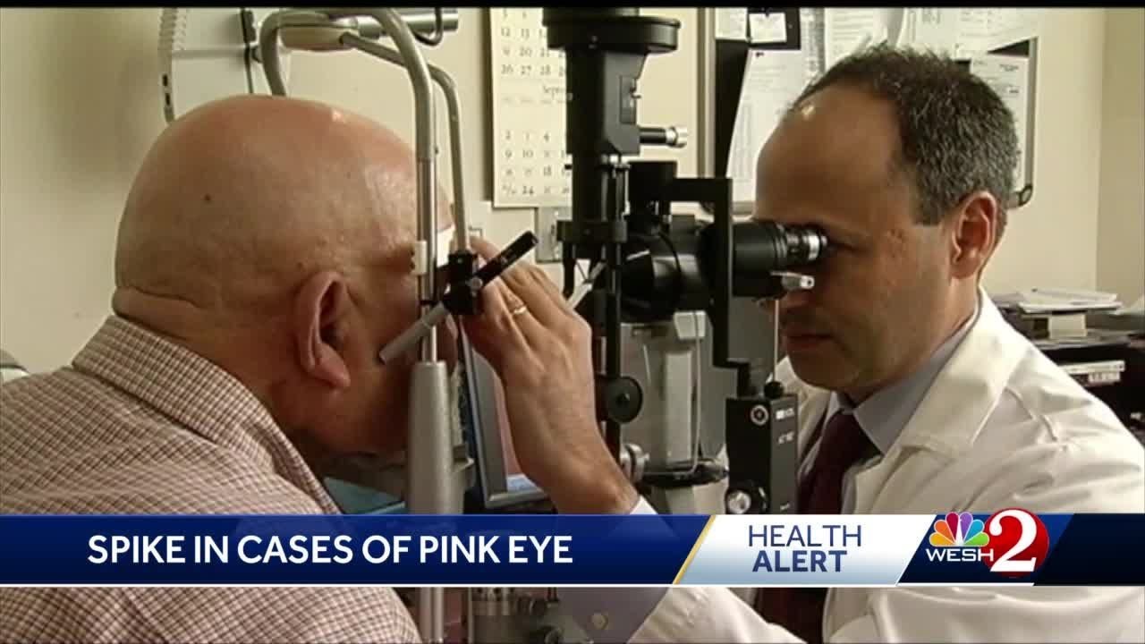 Experts explain cause of rising pink eye cases in Florida - YouTube