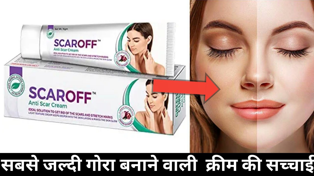 Scaroff Herbal Scar Removal Cream | how to fade scars | how to get rid ...