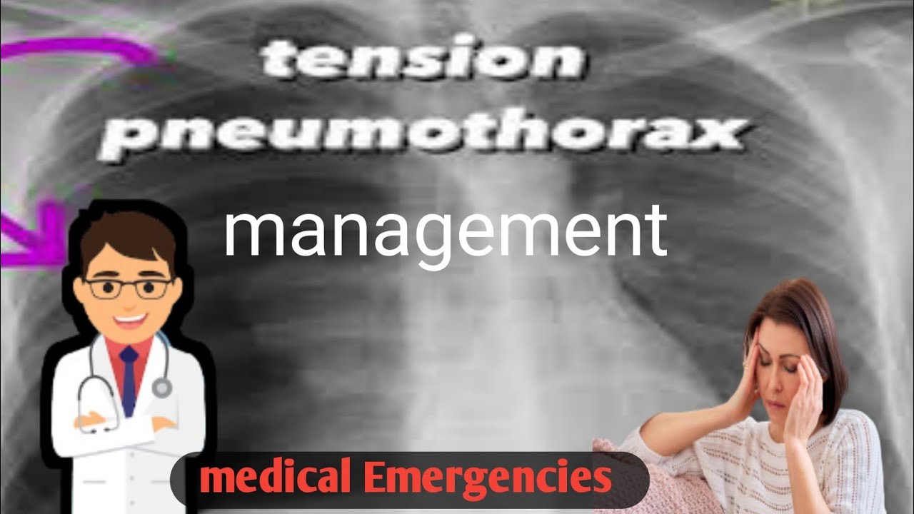 management of tension pneumothorax - YouTube