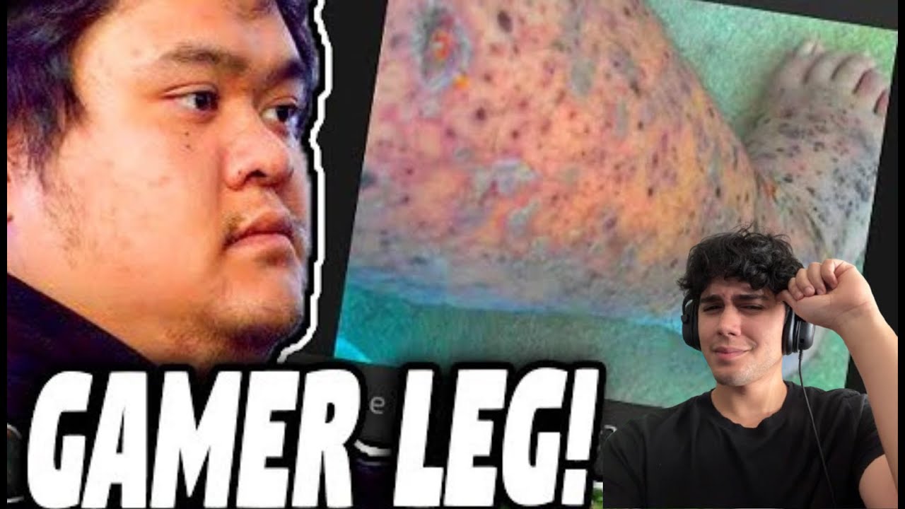 GAMER LEG, O QUE É? REACT - YouTube