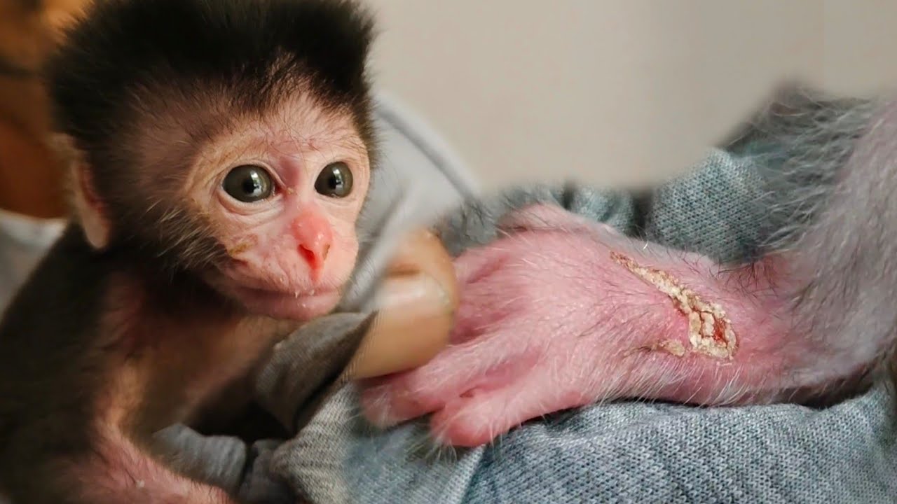Severe leg injuries suffered by a newborn monkey, his condition is now ...
