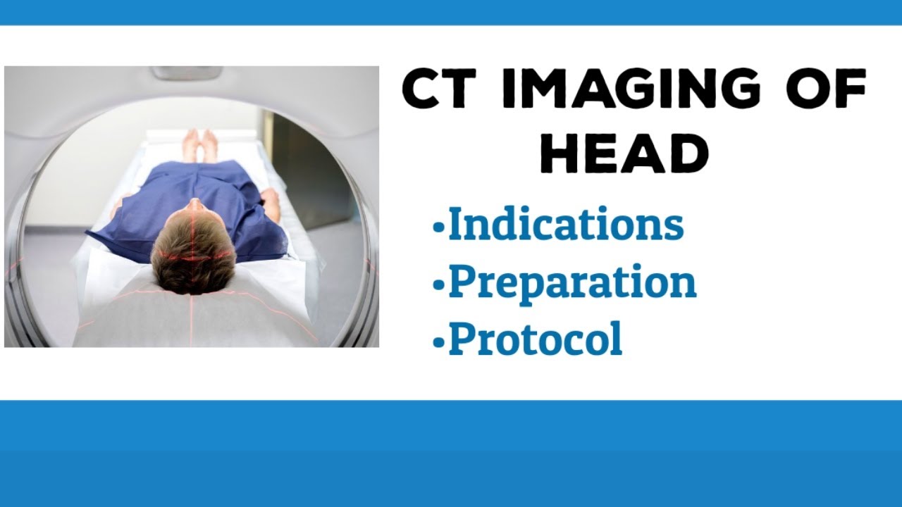 CT Imaging of Head | CT head indications | CT head preparation | CT ...