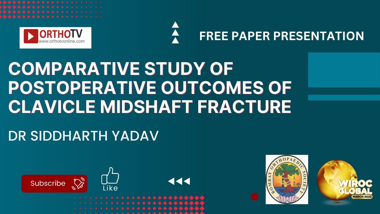 Comparative Study of Postoperative Outcomes of Clavicle Midshaft ...
