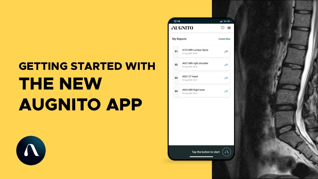 Getting started with the NEW Augnito App - YouTube